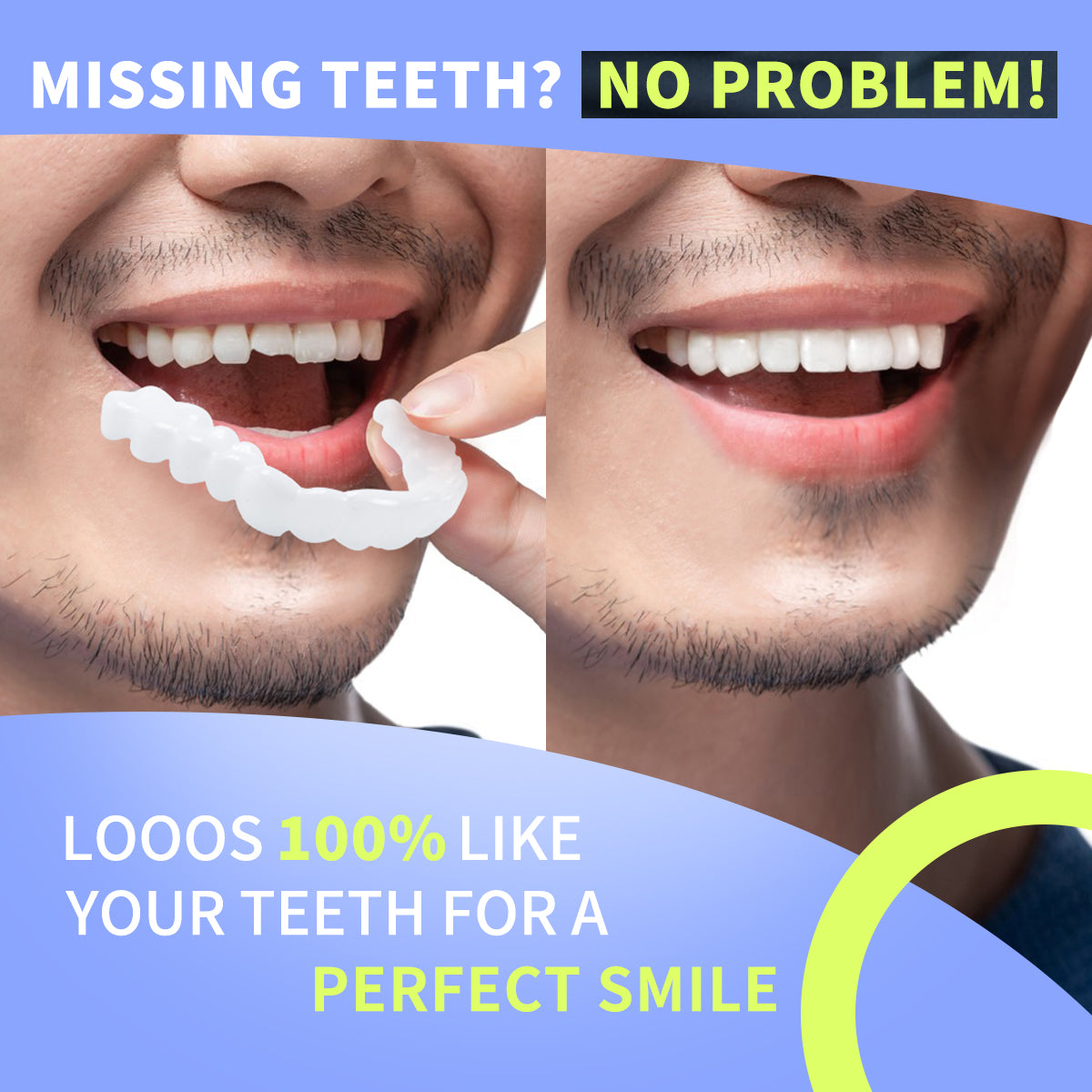 2pcs Teeth whitening custom-made fake braces Fake Teeth Veneers ...