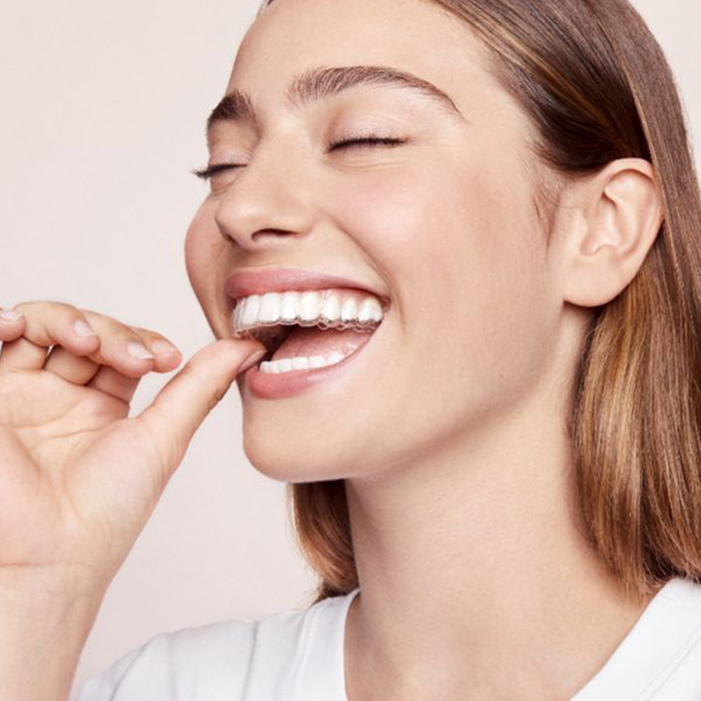 Smileins Invisible braces – smileins.com